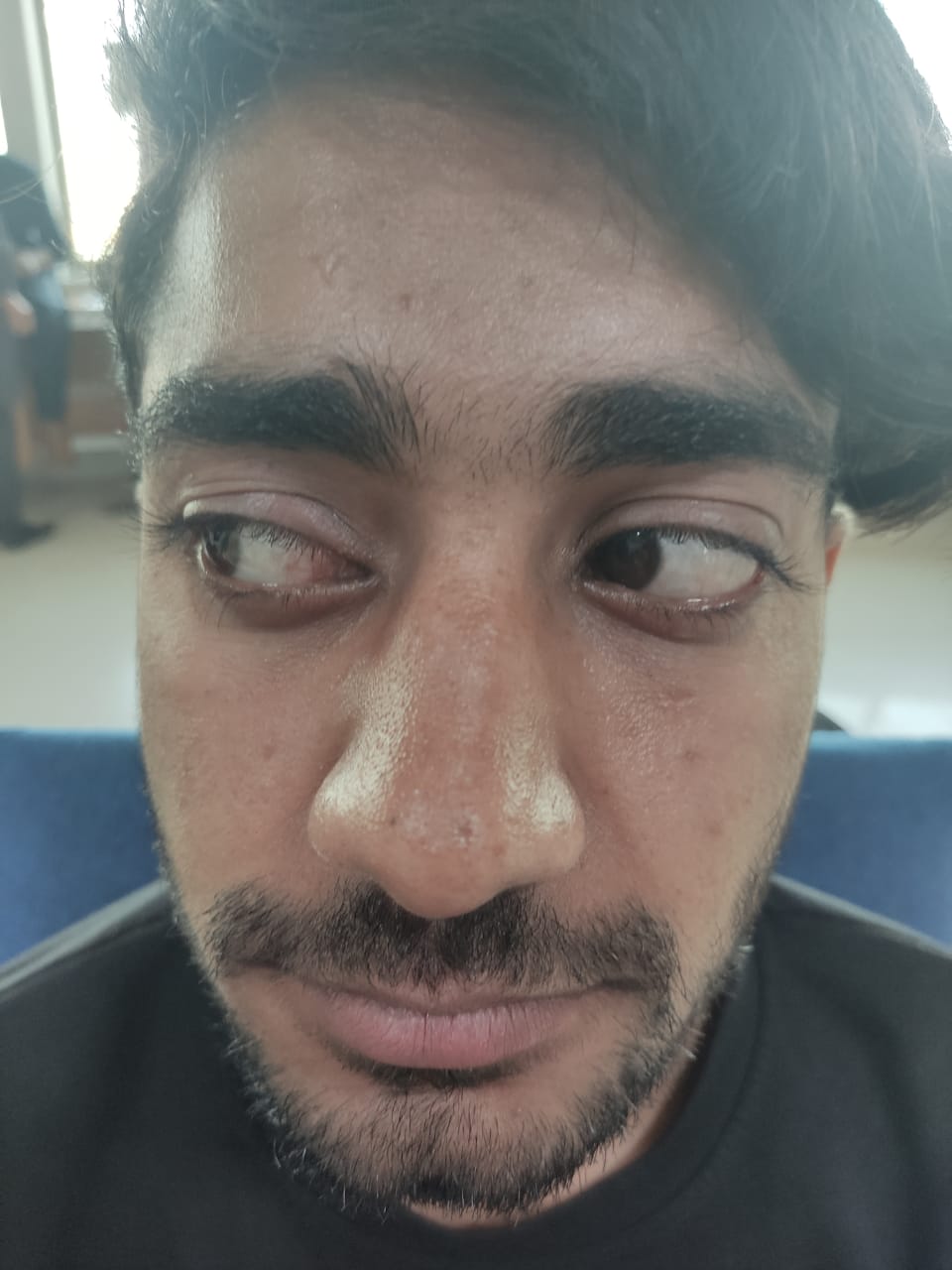 Eyes Object Detection Dataset by new-workspace-7i6vh