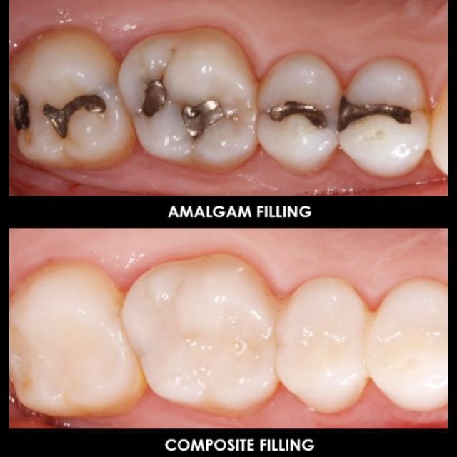 Ai In Healthcare Object Detection Dataset And Pre Trained Model By Mgr