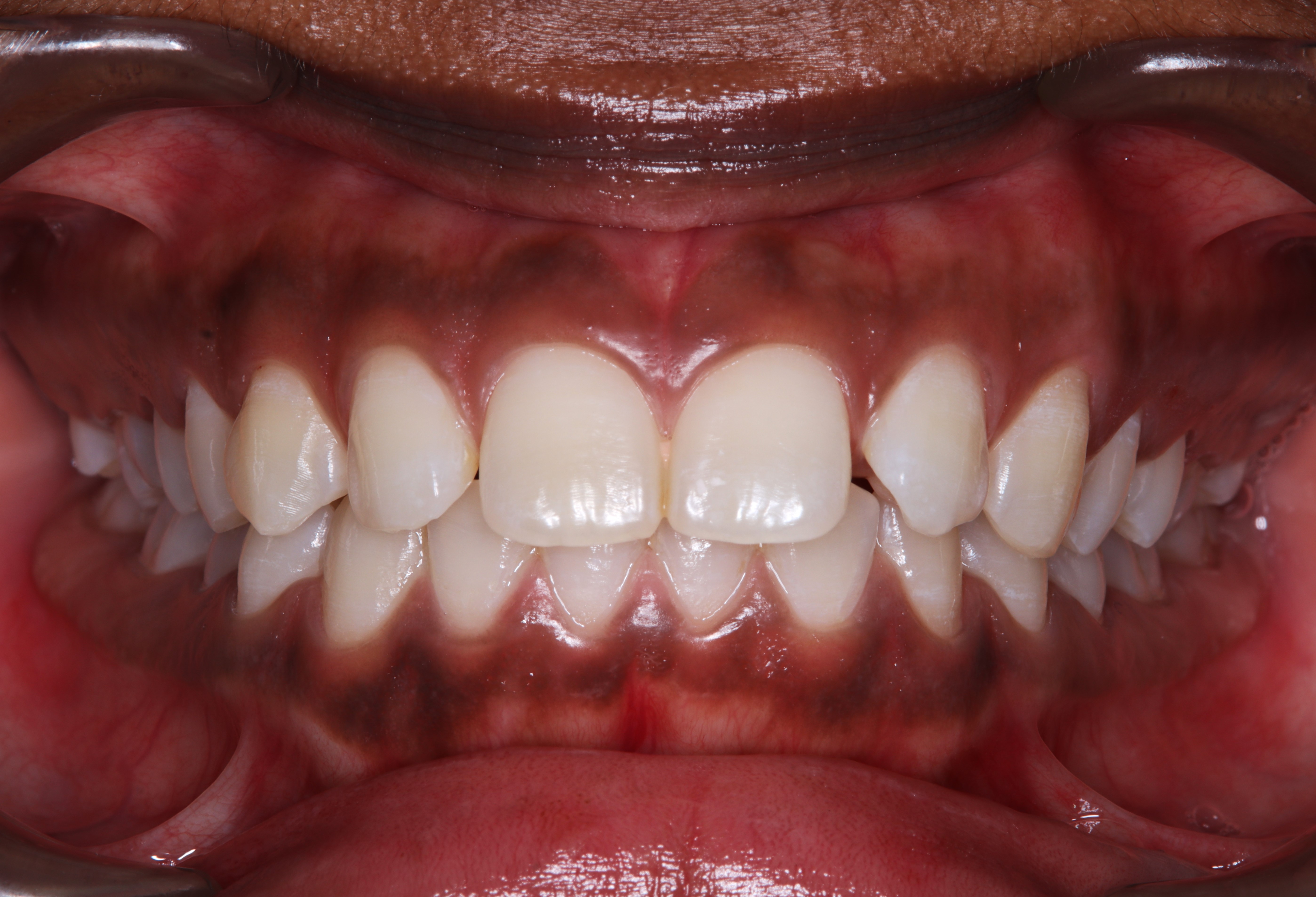 Mgr Cde Ai Roboflow Universe