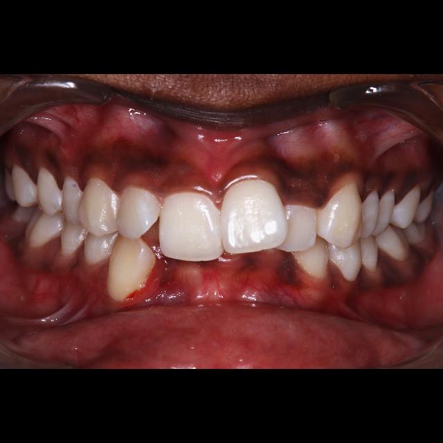 Frontal Ortho Ai Object Detection Dataset And Pre Trained Model By Mgr Cde Ai