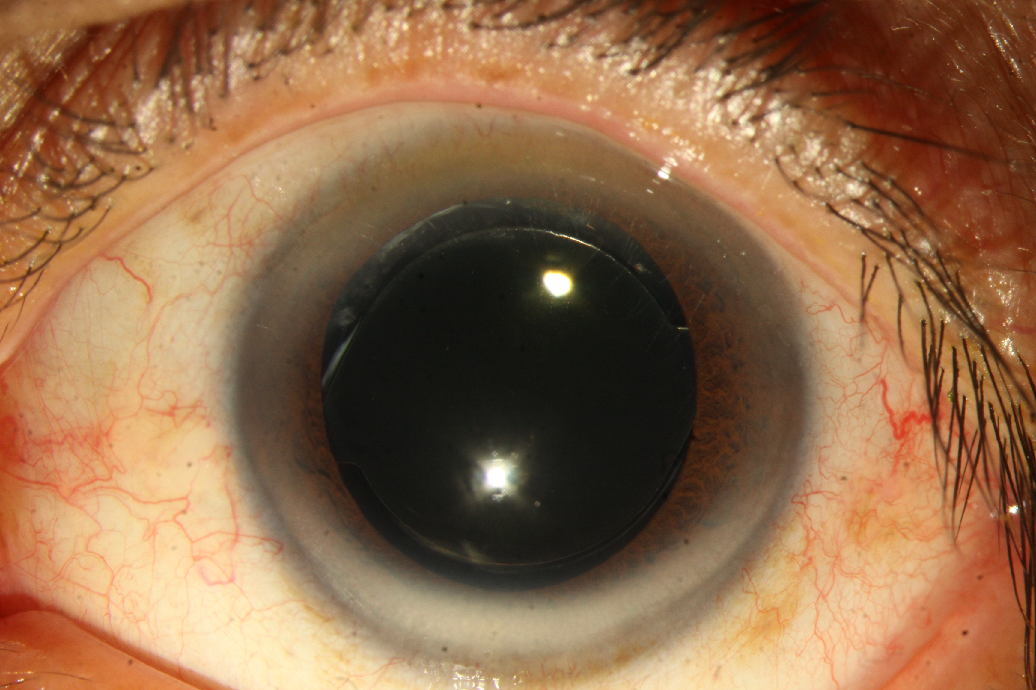 segmantation Pupil Instance Segmentation Model by YOLO PFE