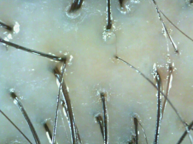 hair_follicle Object Detection Model by project