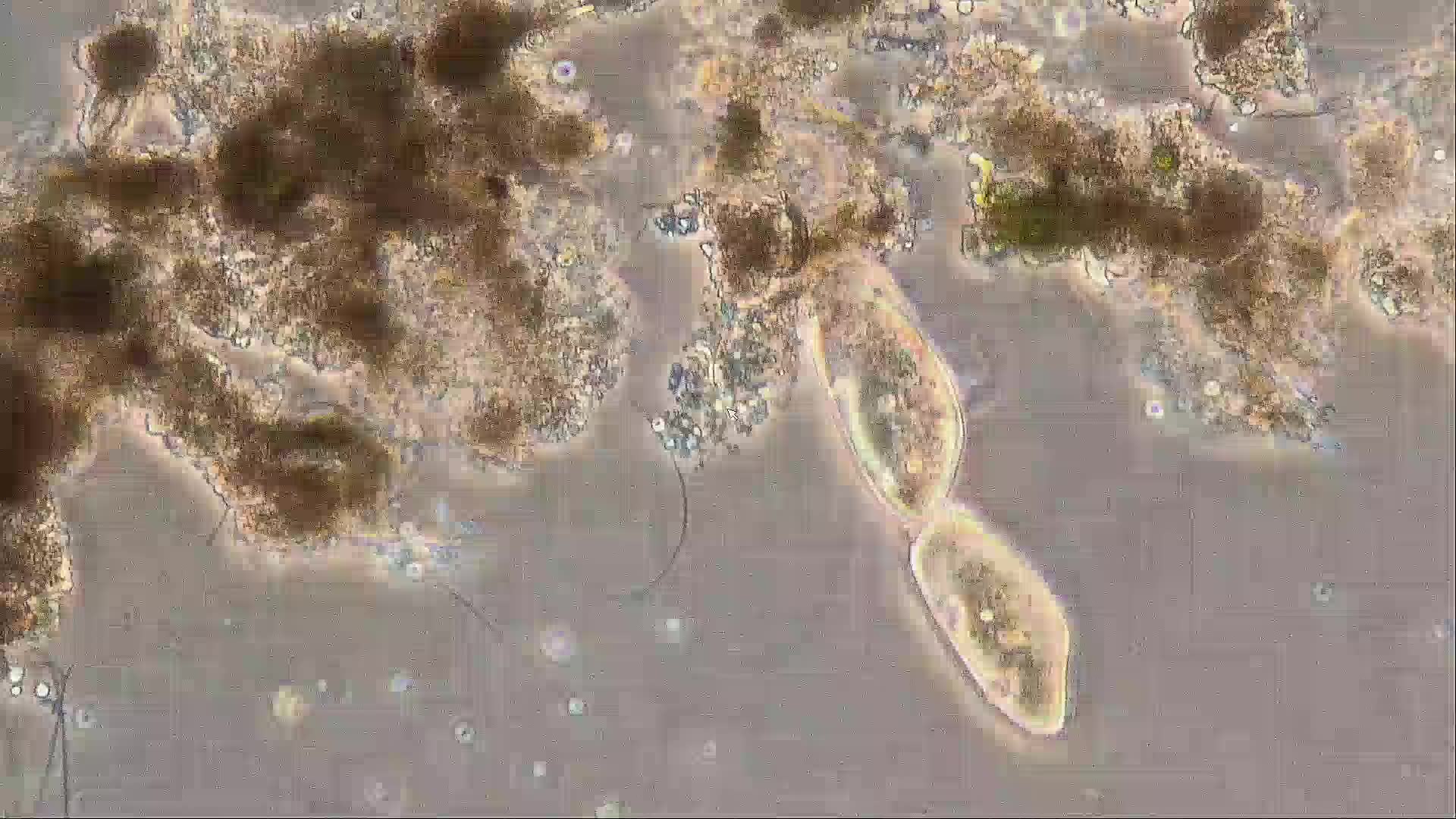 microbe Object Detection Dataset by NYCU