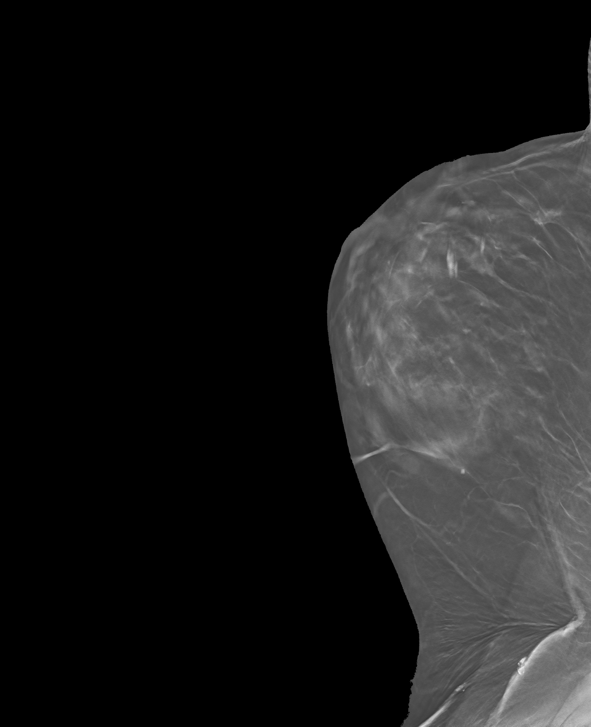 Dbt Multiple Batch10 Object Detection Dataset By Test