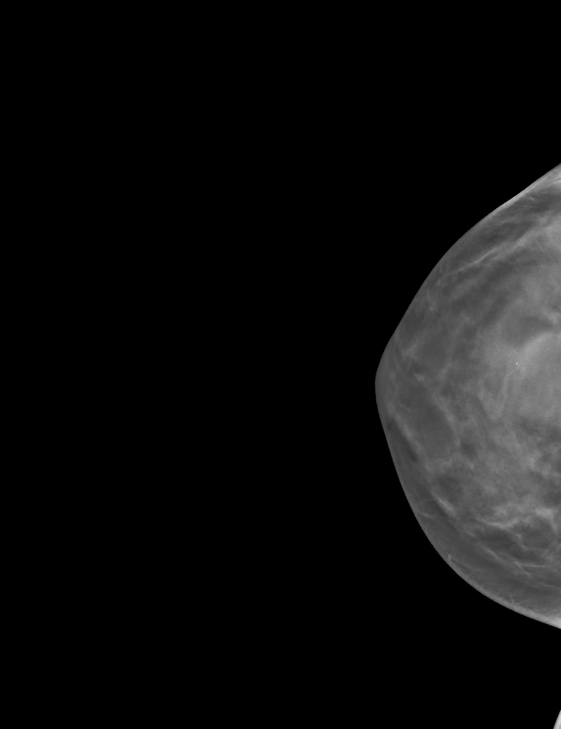 Dbt Multiple Batch4 Object Detection Dataset By Test