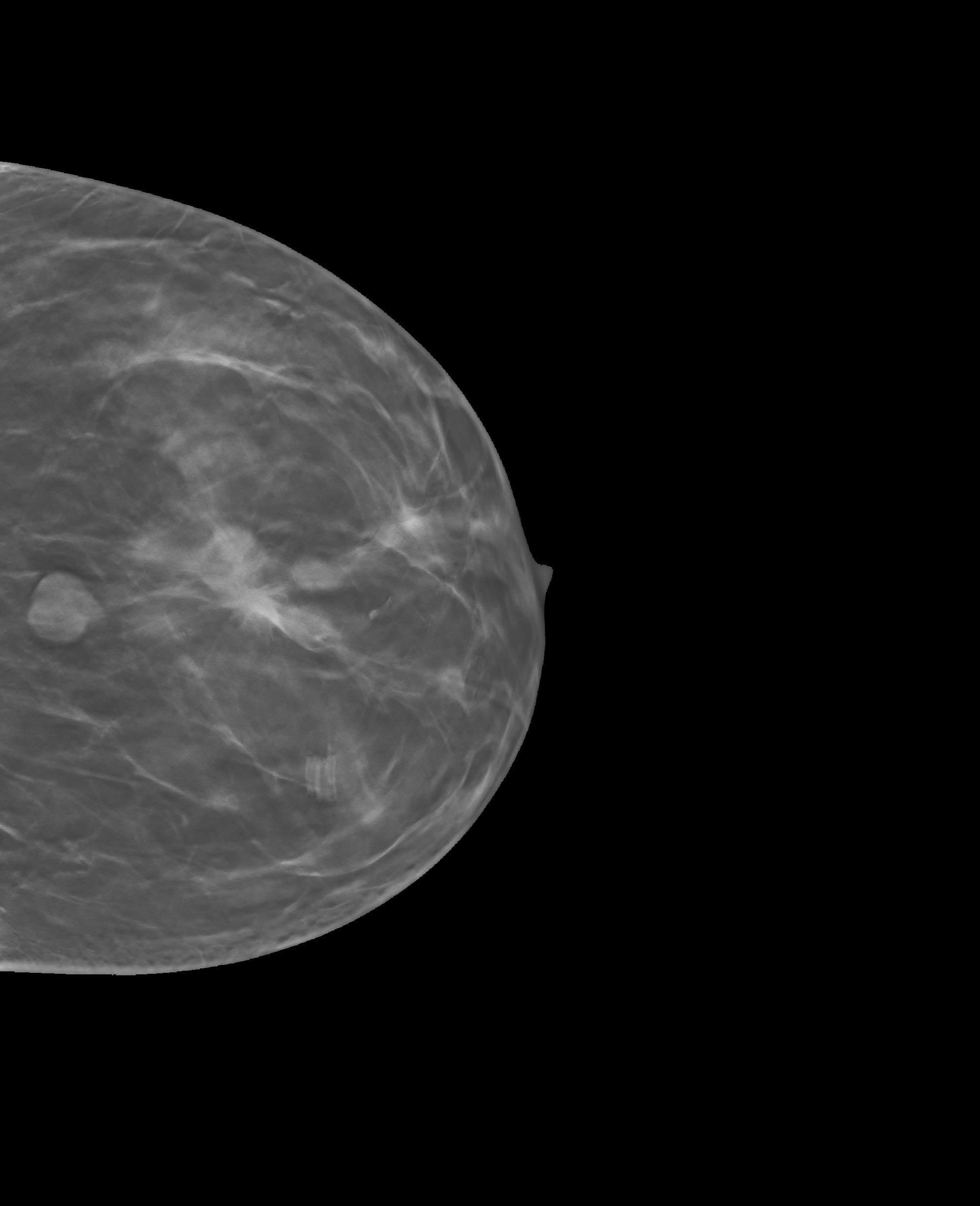 Dbt Multiple Batch5 Object Detection Dataset By Test