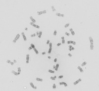 chromosome instance segmentation (chromosome-instance-segmentation-v6btt) - Roboflow Universe