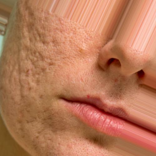 skin deficiency Instance Segmentation Model by face