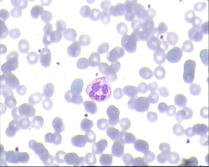 AgroR Classification Dataset by MechAn