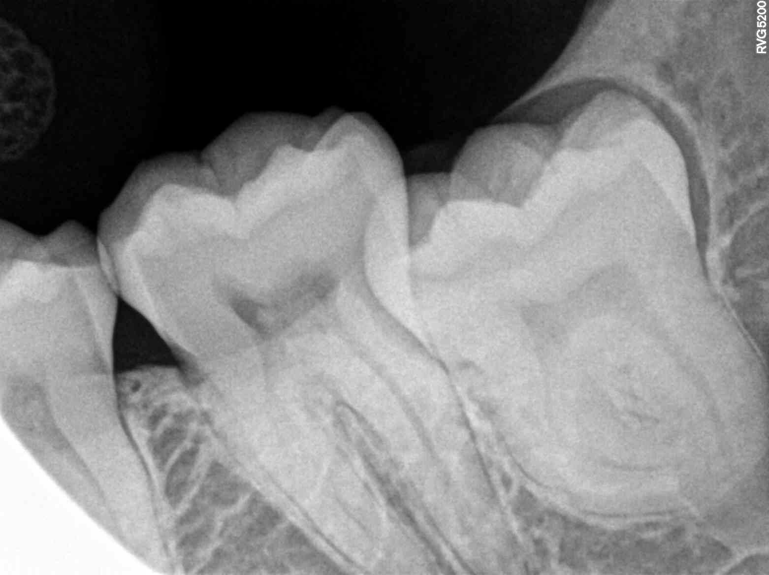 TZ DEVELOPER - Roboflow Universe