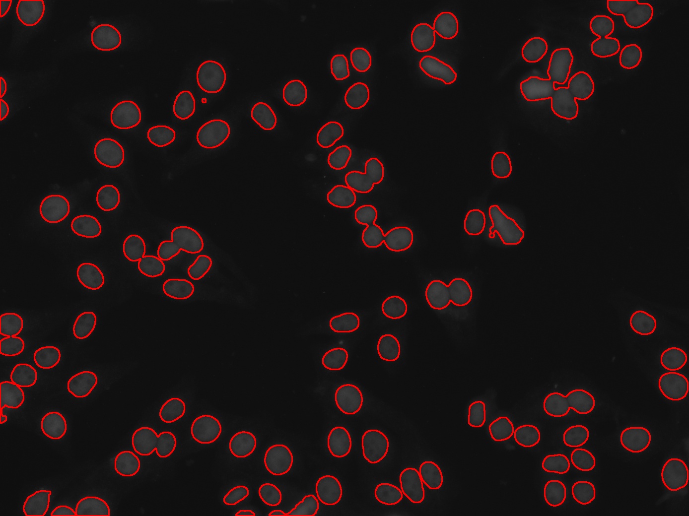 HEP2 Instance Segmentation Model by MS Ramaiah