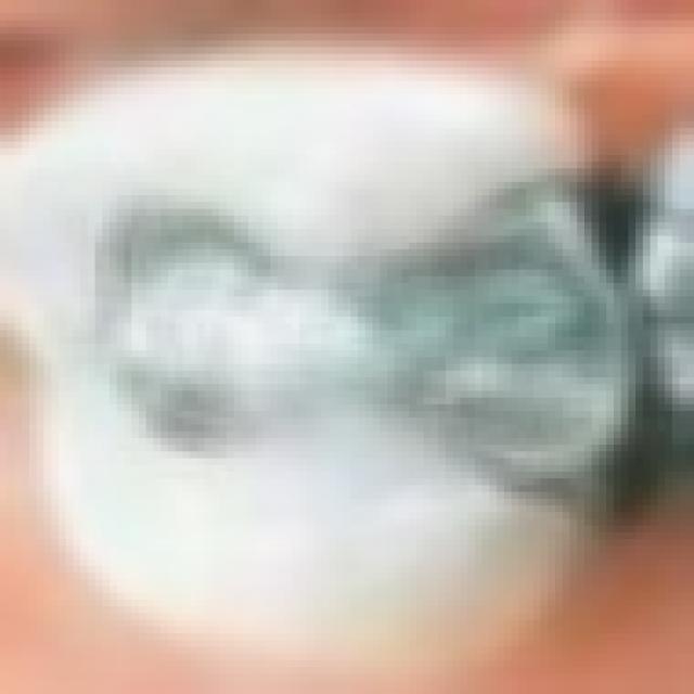 How to Use the dental_project Instance Segmentation API