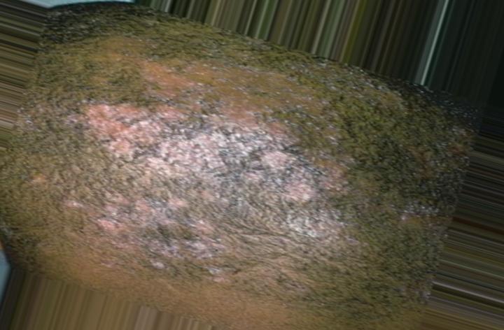 Machine Learning (machine-learning-sftug) - Roboflow Universe