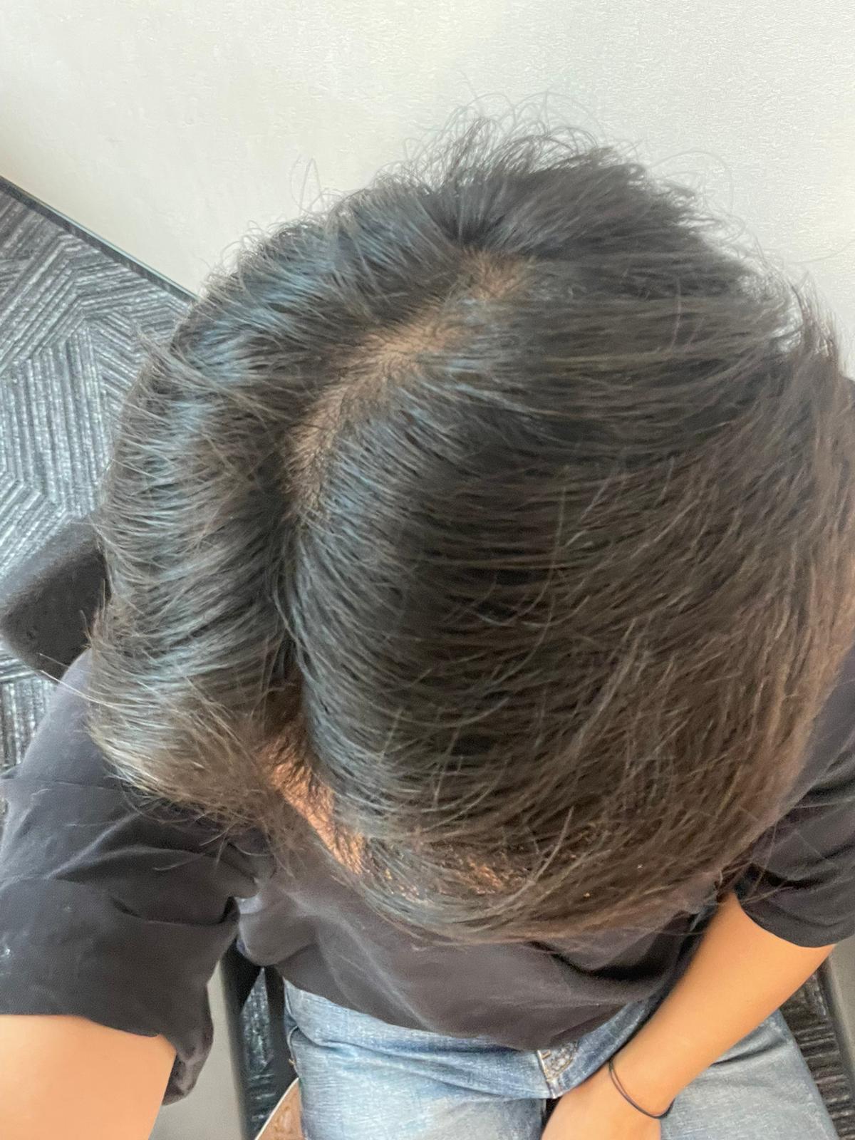 Top-of-Head-Detection Object Detection Model by HairCoSys