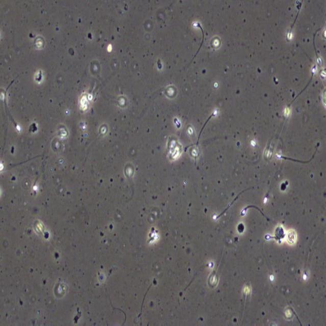 pengenalan sperm-nonsperm 2 Object Detection Dataset by pengenalan spermnonsperm