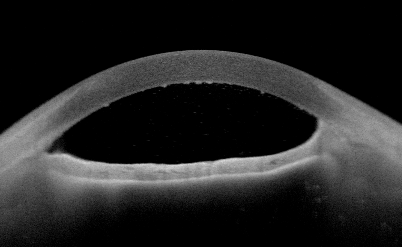 eye Object Detection Dataset by new-workspace-9v21s