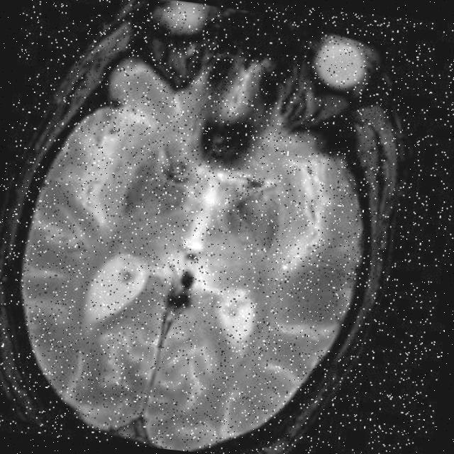 How To Use The Alzheimer Disease Detection Yolov5 Object Detection Api