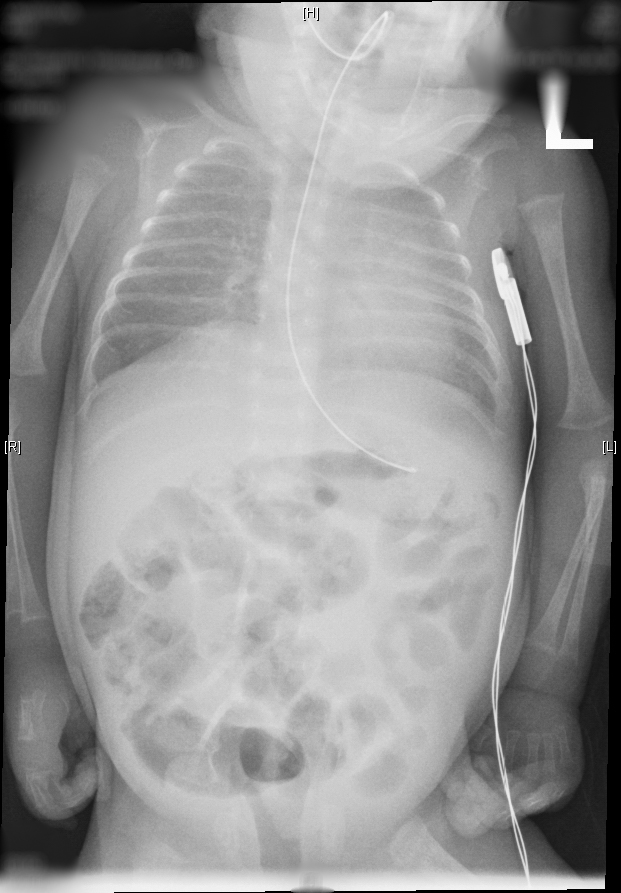 Medical Analyzer Object Detection Dataset by Sergei Simakov