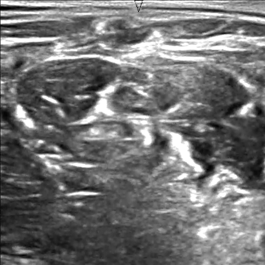 Detect Aug Object Detection Model By Aug