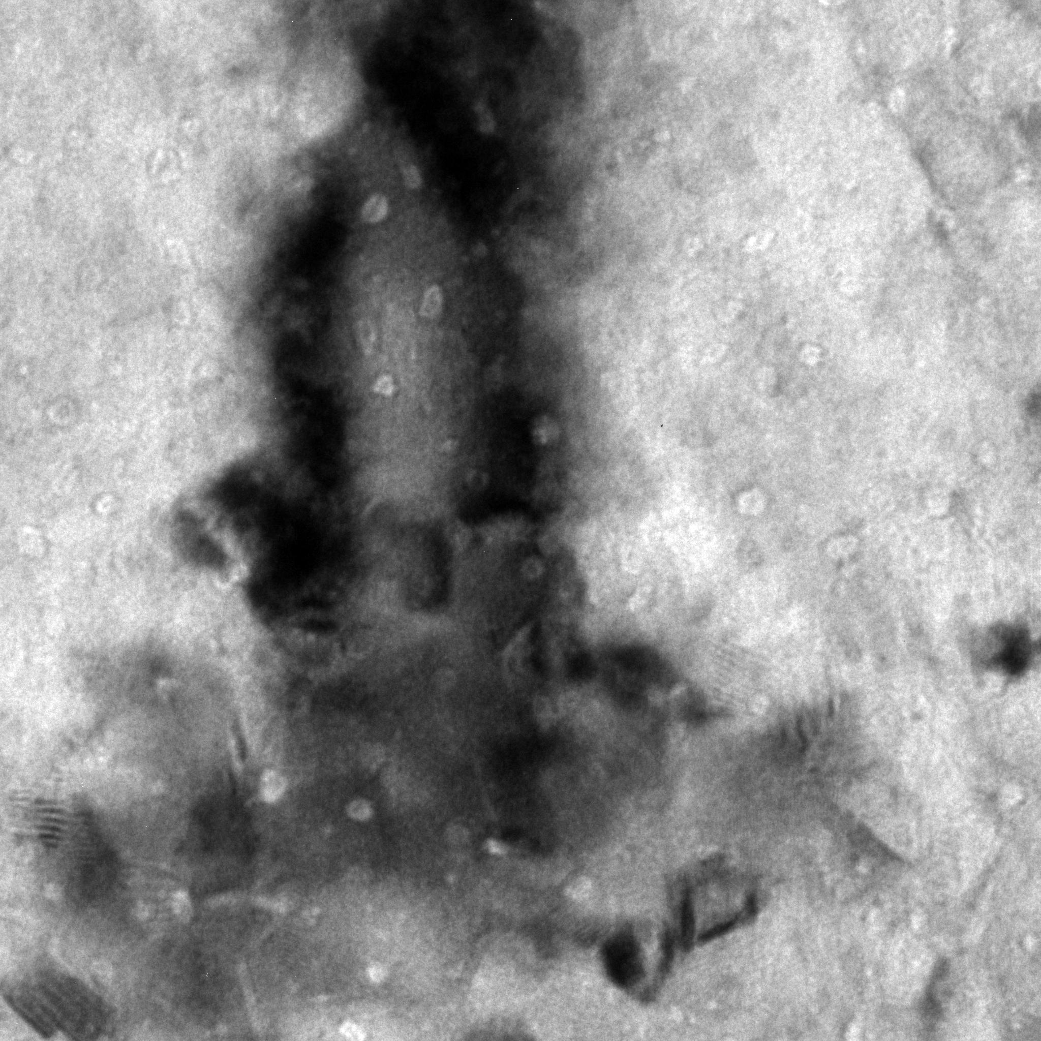 Microscopy Instance Segmentation Dataset and Pre-Trained Model by ...