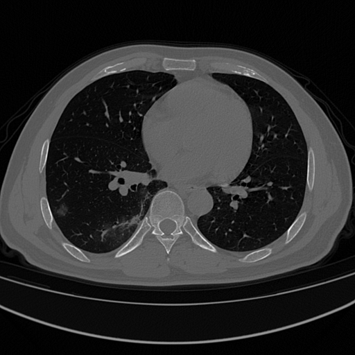 lung Object Detection Dataset by TESTING