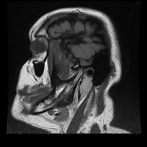 mrt Instance Segmentation Dataset by workspacemri