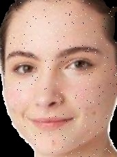 Skin Types Classification Dataset by facial skin type classification