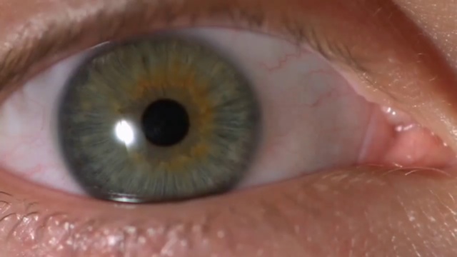 iris_120_set Object Detection Model by new-workspace-0xdgg