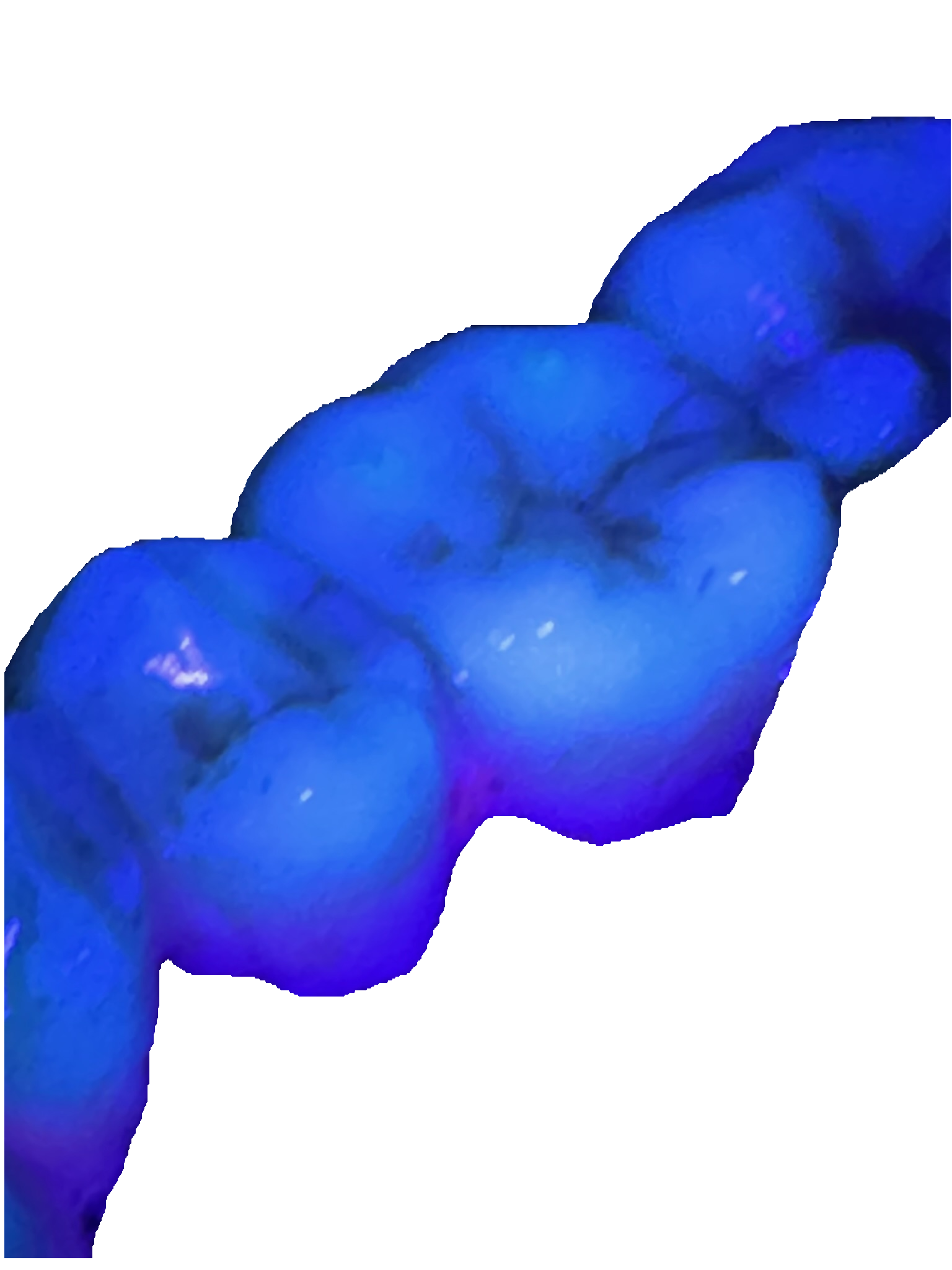 Plaque Detection Instance Segmentation Dataset And Pre Trained Model By