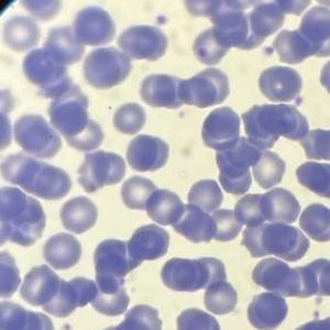 gplt Object Detection Dataset by giantpaltelet