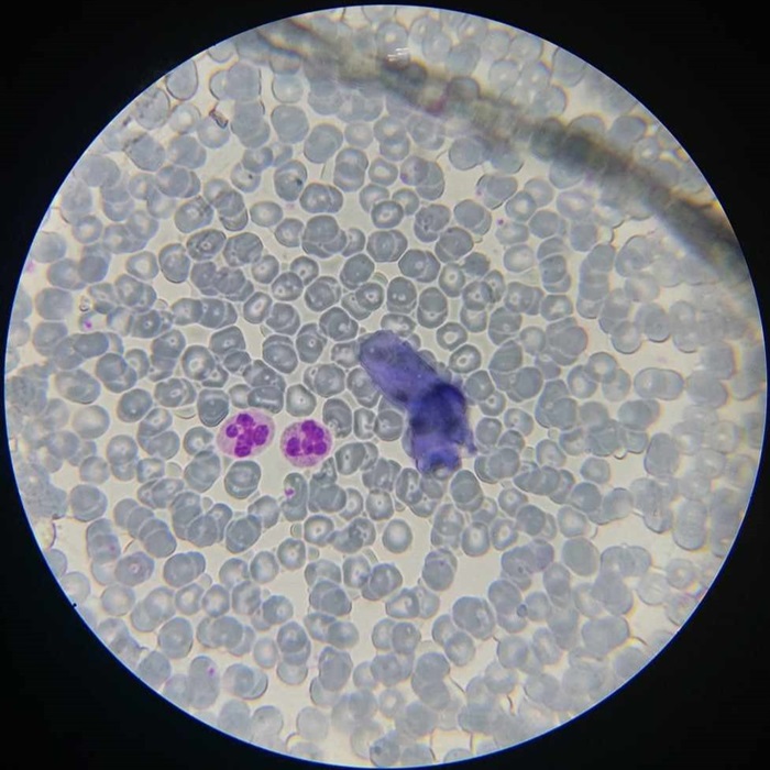 detect_wbc Object Detection Dataset and Pre-Trained Model by augment