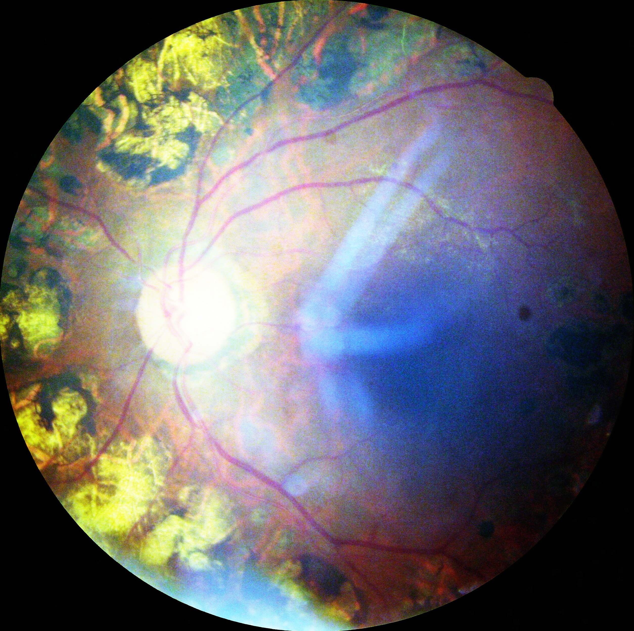 DR Classification Classification Dataset by Alvin Pratikta