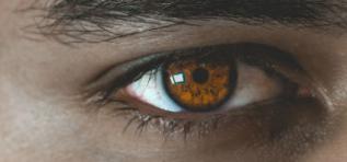 cataract-severity Instance Segmentation Dataset by ceran