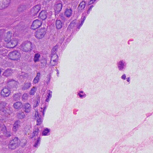 cell Instance Segmentation Dataset by summer