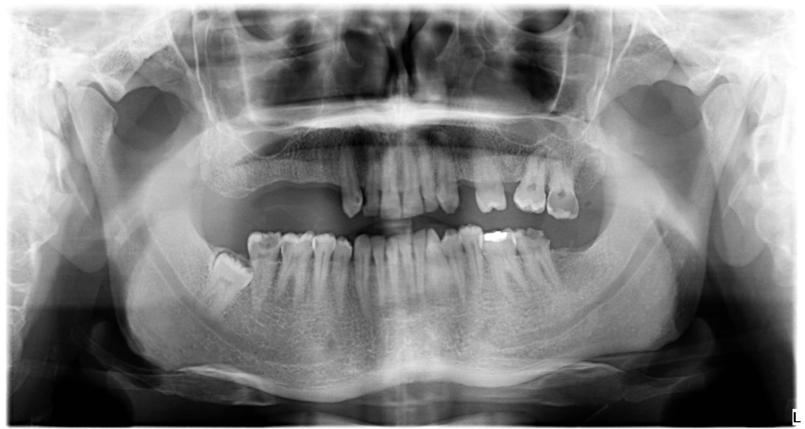 Teeth Project Classification Dataset And Pre Trained Model By Create