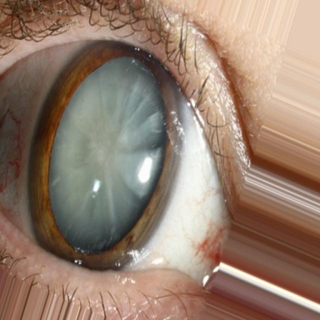 Eye Object Detection Dataset by Siams workplace