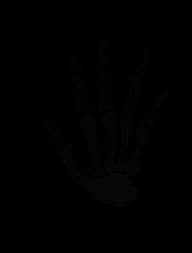 Project_detection_os Object Detection Dataset and Pre-Trained Model by Workspace