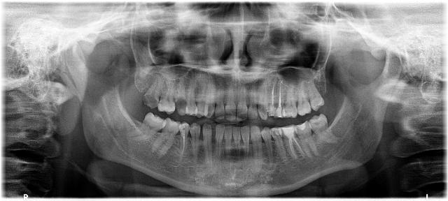 Crop And Resize Object Detection Dataset By Mike