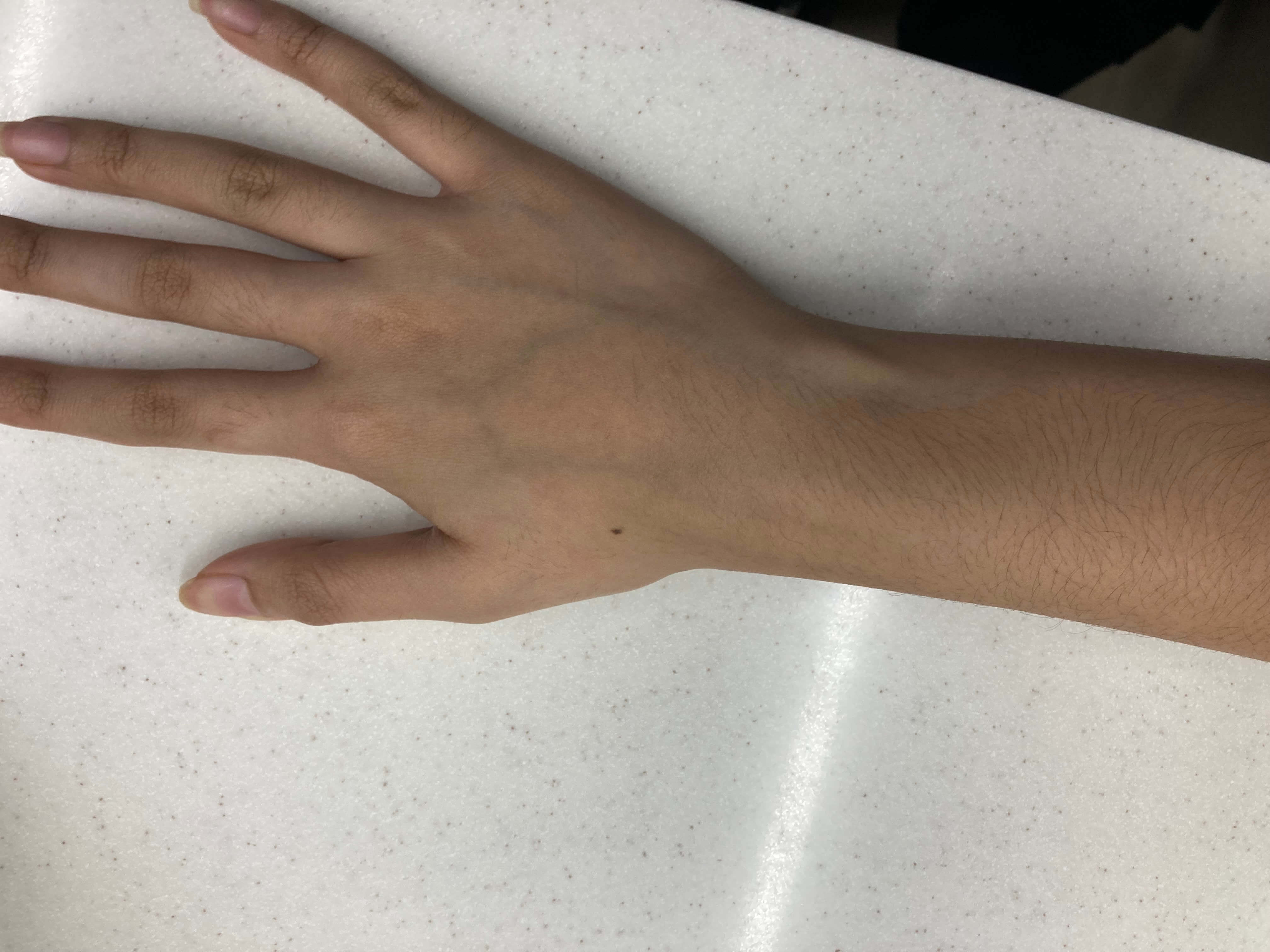 Skin pigment Object Detection Model by art