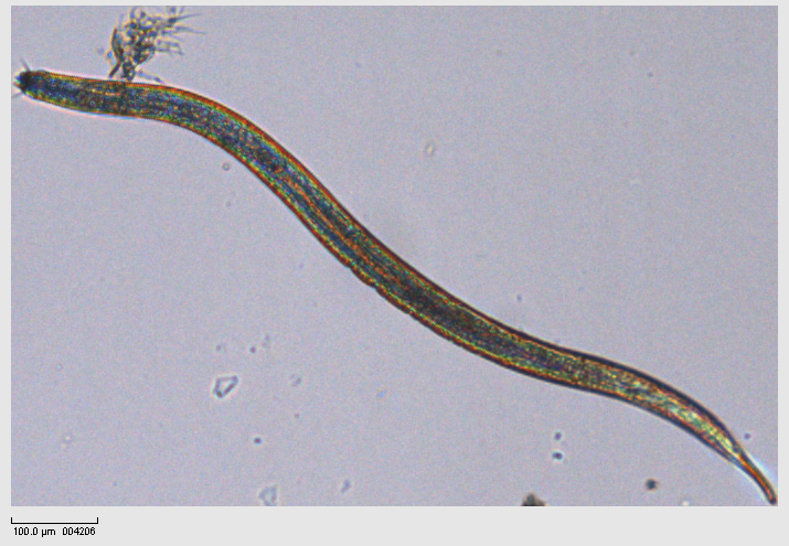 Detection Oesophagus Tail Object Detection Dataset And Pre Trained Model By Yolov11