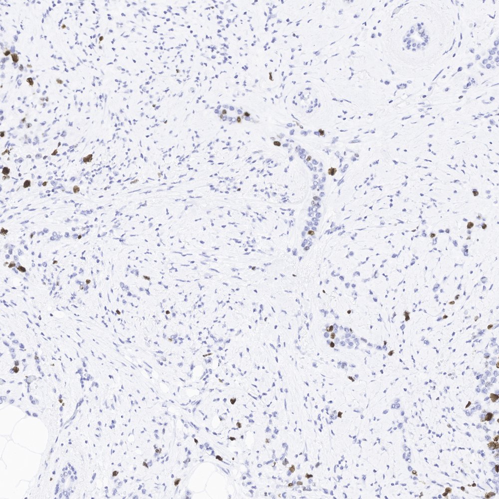 IHC_PT2 Instance Segmentation Model by IHC