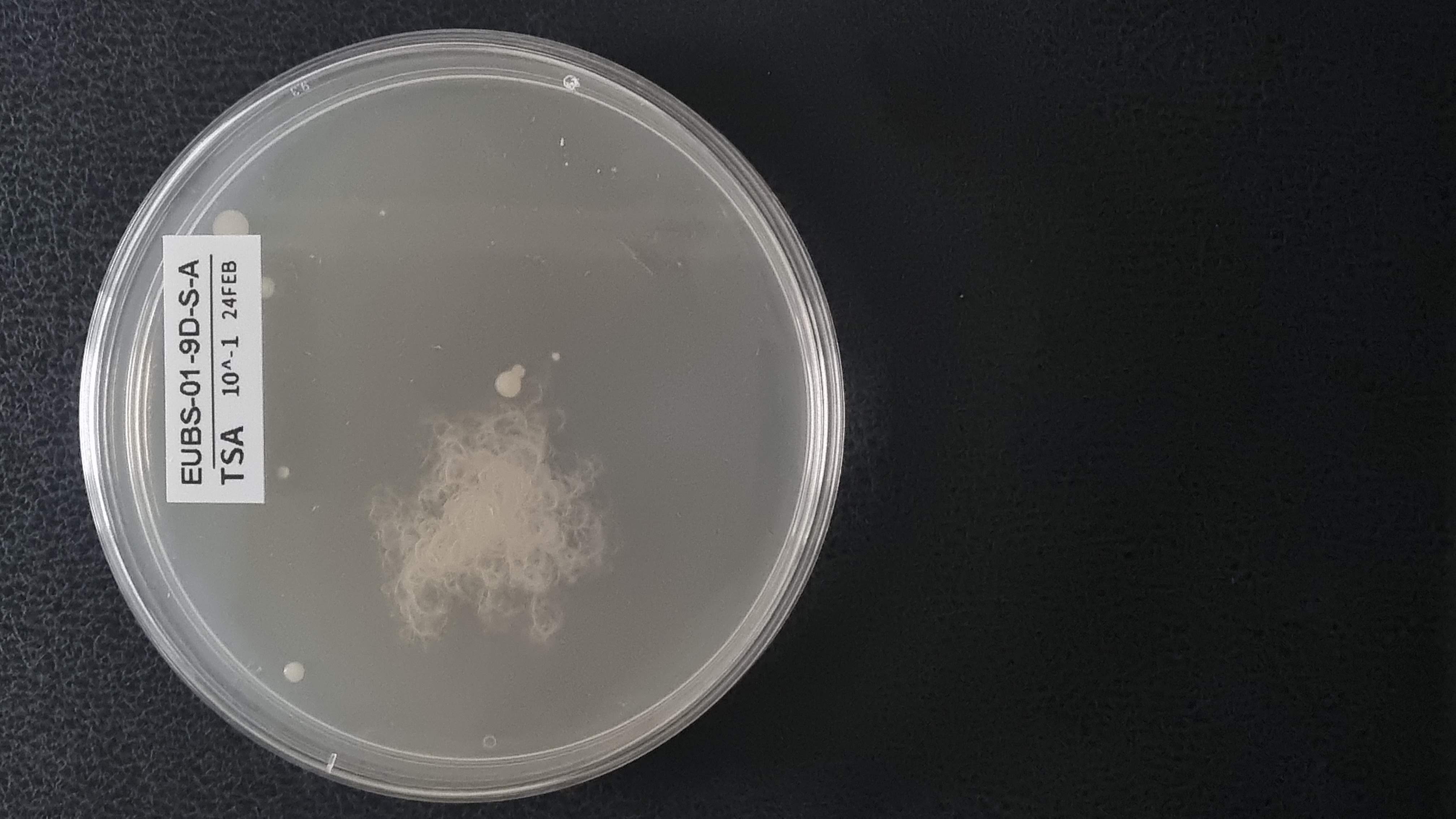 class:agar-plate | Roboflow Universe Search