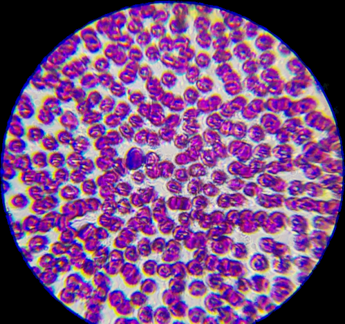 Platelet-WBC Object Detection Dataset by segment