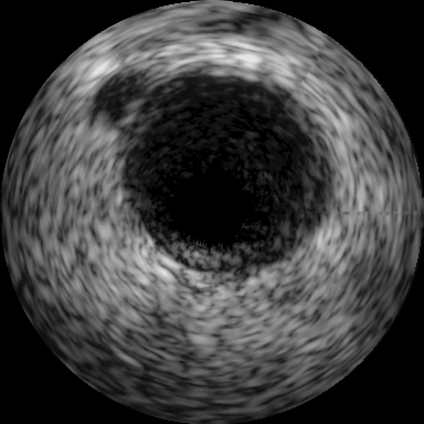 IVUF-100 Object Detection Dataset and Pre-Trained Model by Exscan