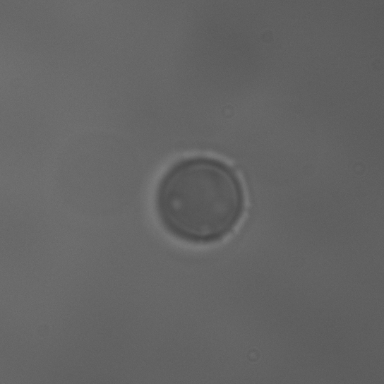 RBC Object Detection Dataset by MicroscopeParticlesandPipette