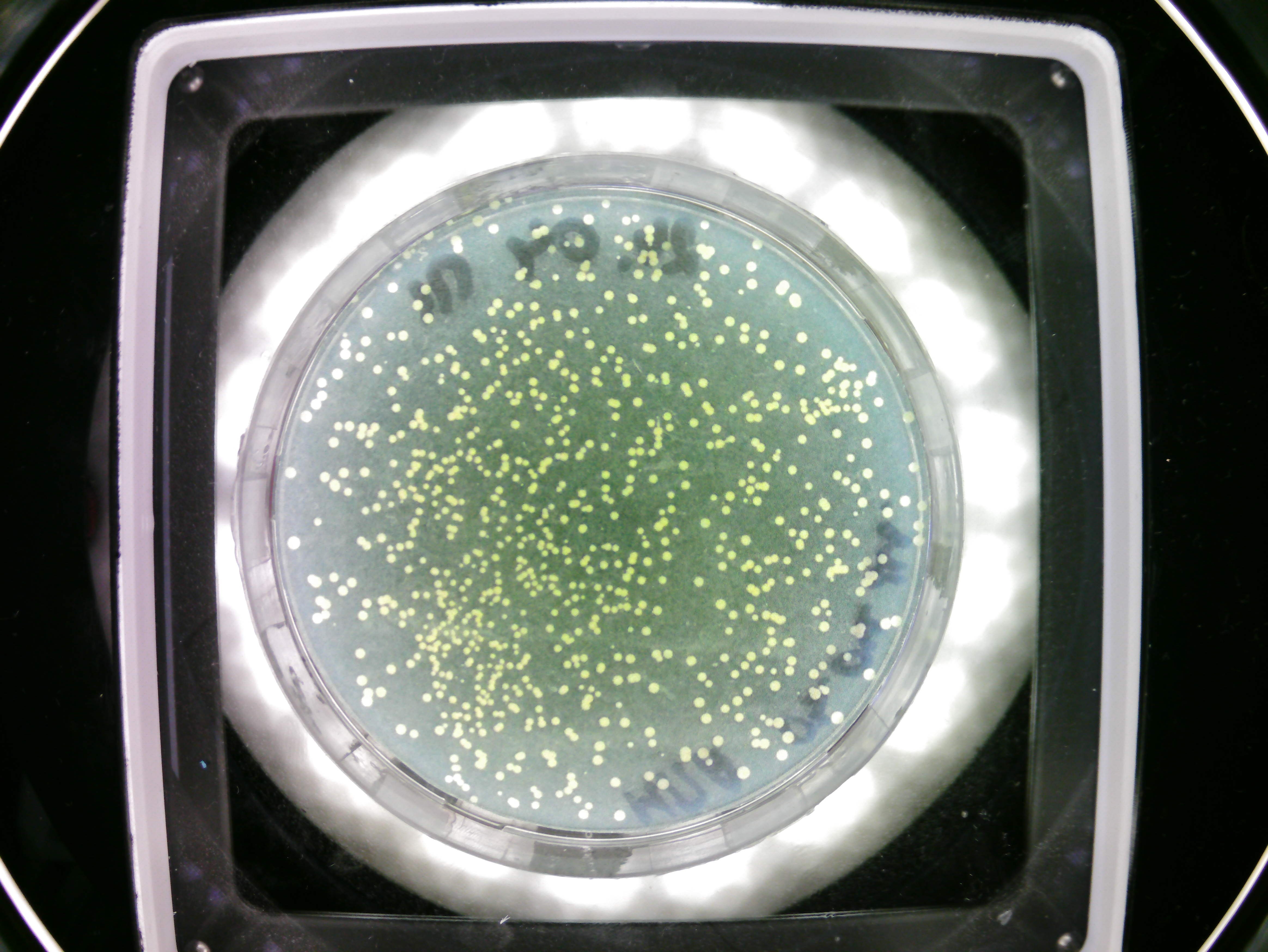 colon_list Object Detection Dataset by agar