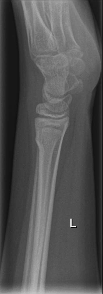 111 Object Detection Dataset by ker