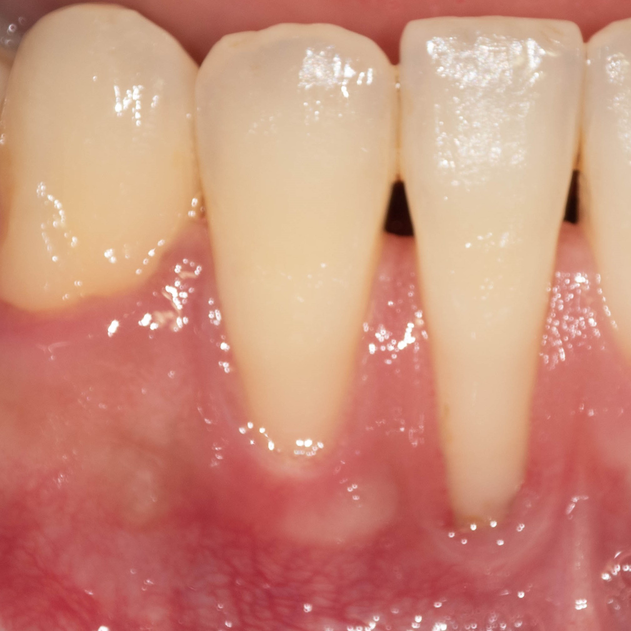 MRC 2 Object Detection Dataset by dan kook