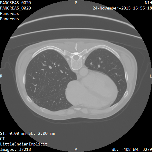 pancreas ct Instance Segmentation Dataset and Pre-Trained Model by ... pancreas ct Instance Segmentation Dataset and Pre-Trained Model by ...