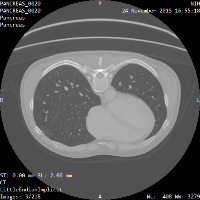Object detection (object-detection-ga8tf) - Roboflow Universe